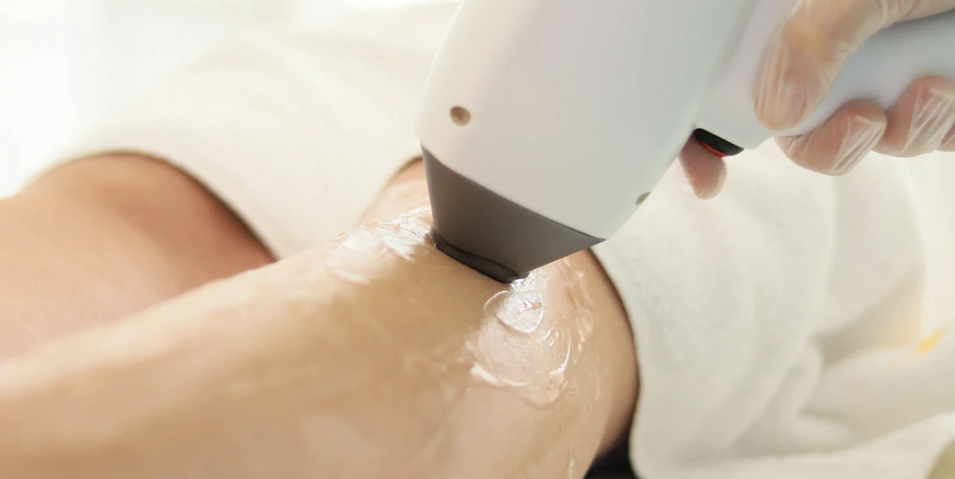 Laser Hair Removal Pricing in Sterling, Virginia - Prolase Medispa | #1 ...