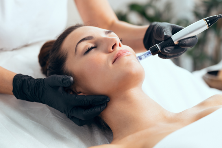 Microneedling Specials in Falls Church, Virginia: How to Uncover ...